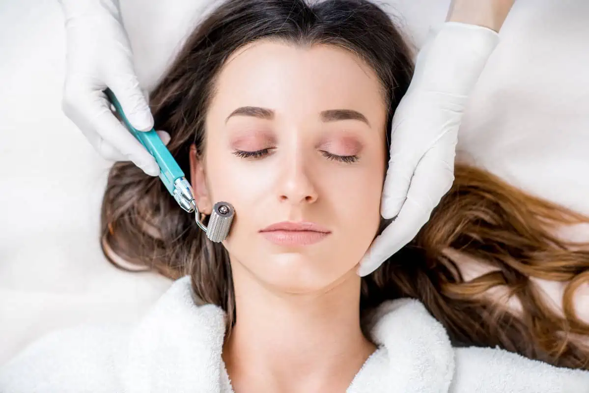 Microneedling Pros and Cons | What to Know Before You Book